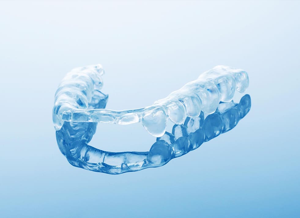 Nightguard In Richmond TX - Inspire Smiles